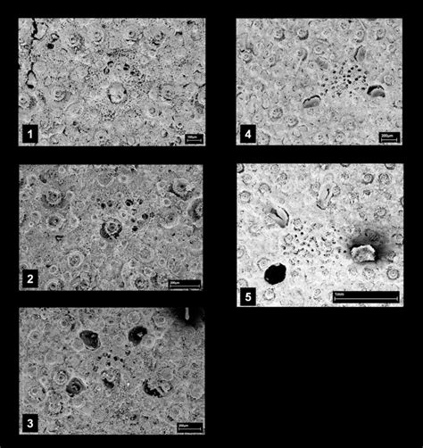 Fig C5 Cassidulus Caribaearu M Clases 1 5 Sistema Apical