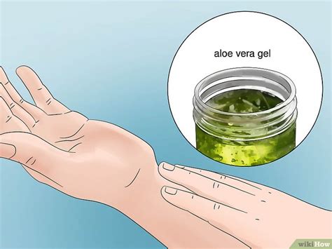 Formas De Curar Las Picaduras De Pulgas WikiHow