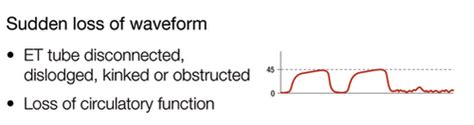 Capnography Flashcards Quizlet