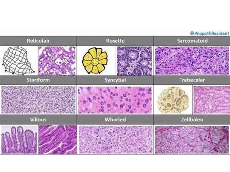 Histopathological Patterns Pptx