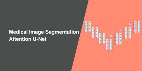 Biomedical Image Segmentation U Net By Jingles Hong Jing Tds