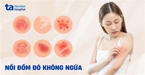 Bị Nổi đốm đỏ Trên Da Và Ngứa Nguyên Nhân Do đâu Có Nguy Hiểm