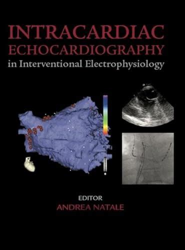 Intracardiac Echocardiography In Interventional Want It All
