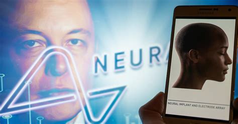 Musk Neuralink Ha Installato Il Primo Impianto Cerebrale Su Essere Umano