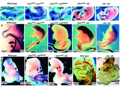 Gut Phenotypes Of Pitx2 Allelic Combinations A E Gut Looping In 105