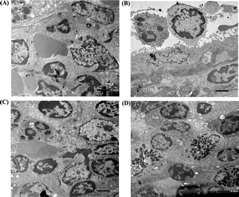 Transmission Electron Micrograph Of Mice Spleen Sections Download