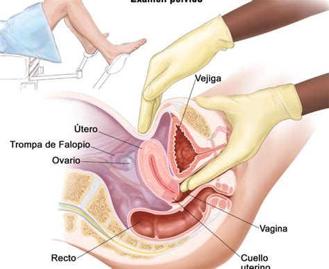 Diagnóstico de Apendicitis Síntomas y Exámenes