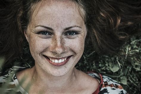 11 натурални начина за премахване на тъмните петна от кожата Всичко
