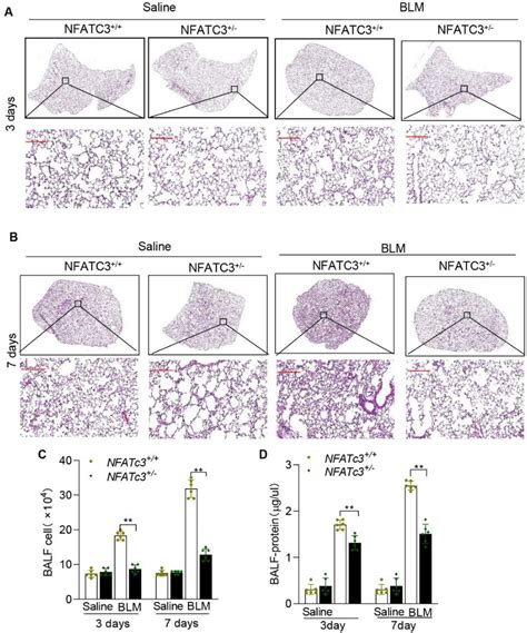 Figure 4 From Nfatc3 Promotes Pulmonary Inflammation And Fibrosis By