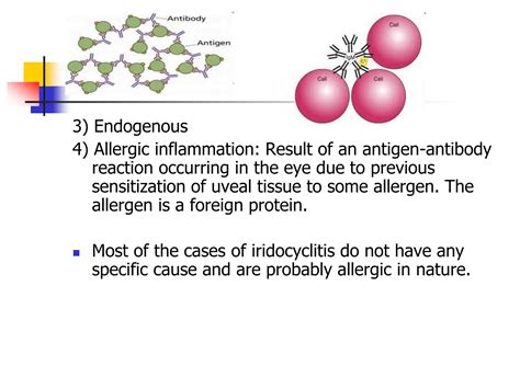 1167anterior Uveitisppt Inflammation Of Iris Cilliary Body Choroid