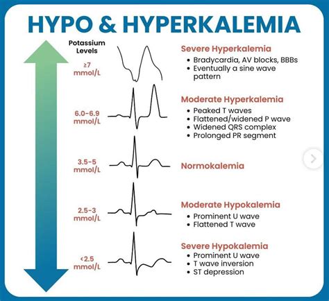 Cardiophilia Hypo And Hyper Kalemia Facebook