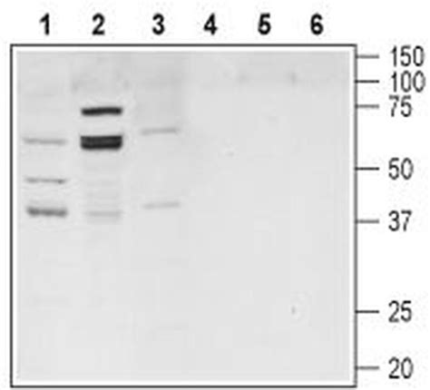 Tgr5 Gpbar1 Polyclonal Antibody Invitrogen Abr 031 200ul