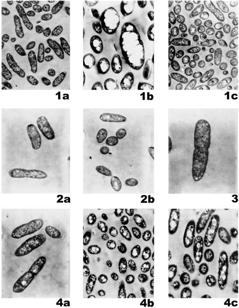 Electron Micrographs 1 P Putida U Wild Type Cultured In Minimal