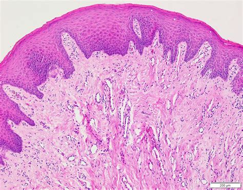 Histology Of The Oral Mucosa Histology And Embryology