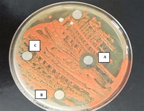 Zone Of Inhibition Of The Effect Of Tam On Cryptococcus Laurentii A Download Scientific
