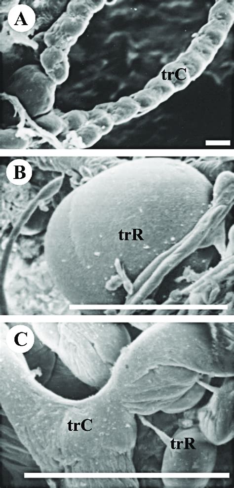 1 Microscopia Eletrônica De Varredura Mev De Fêmeas Semi Ingurgitadas
