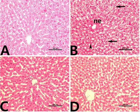 Liver Histopathology In Male Rats After Administration Of Ccl 4 Andor