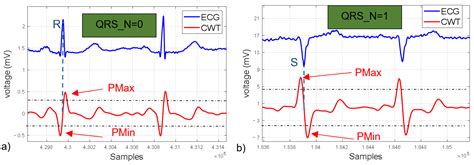 Implementation Of Wavelet Transform Based Algorithms In An Fpga For