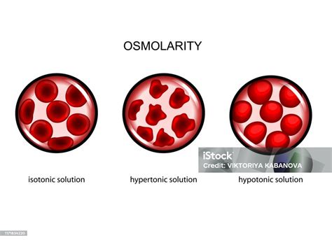 Plasma Osmolarity Isotonic Hypertonic And Hypotonic Solutions Stock Illustration Download