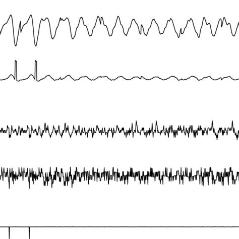 original eeg signals download scientific diagram