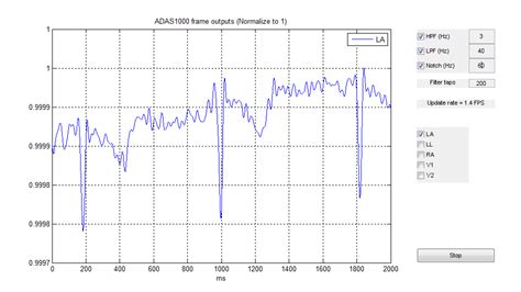 unable to communicate with adas1000 via spi interface qanda precision