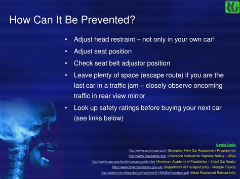 Ppt Whiplash Injury Powerpoint Presentation Free Download Id4857158