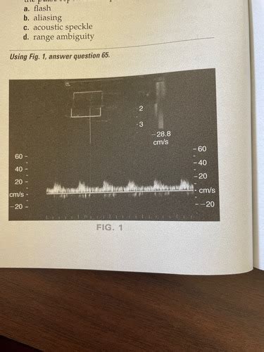 Mock Exam Flashcards Quizlet
