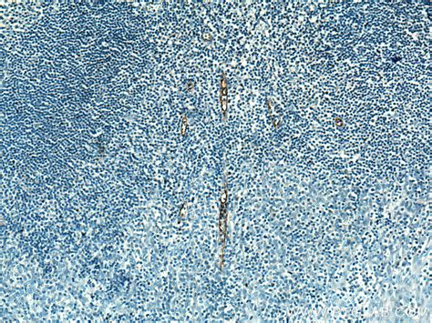 E Selectin Cd62e Antibody 20894 1 Ap Proteintech