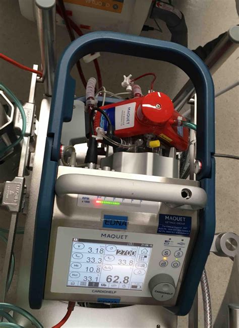 Equipment Used Alfred Ecmo Guideline