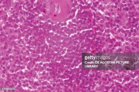 Lymph Node Microscope Photos And Premium High Res Pictures Getty Images