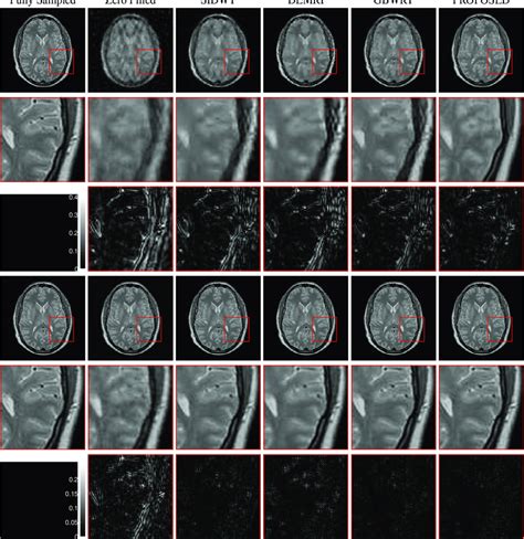 Visual Image Quality Comparison On The Ixi Brain Dataset At A Sampling Download Scientific