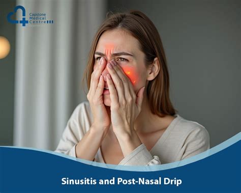 Sinusitis And Post Nasal Drip Understanding The Relationship