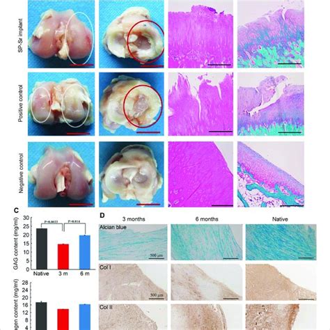 Natural Materials Used For Meniscus Tissue Engineering Download