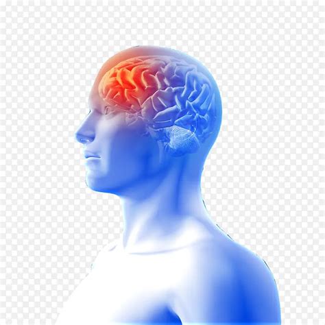 头疼图片png图片素材下载 图片编号8503958 Png素材网