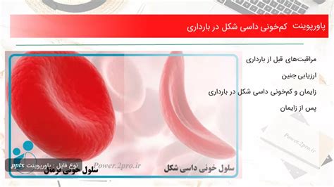 دانلود پاورپوینت کم‌خونی داسی شکل در بارداری کد107888