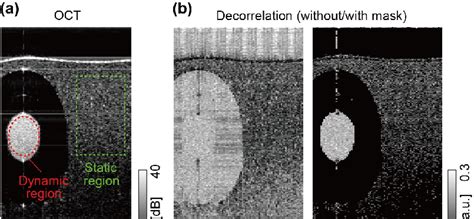 OCT and the standard OCTA results in the phantom experiment a An í Download Scientific