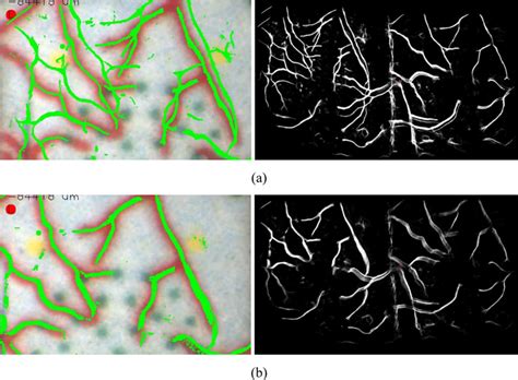 eyesam graph based localization and mapping of retinal vasculature
