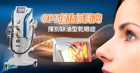 【影文】改善乾眼症全攻略 教你解決眼乾困擾 乾眼症專區 Opt眼科優化脈衝光 台灣醫級邦 Now健康