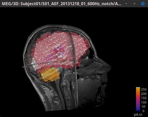 Aligning A Volume Parcellation Atlas To A Group Source Grid