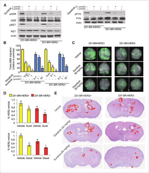 Effects Of Sunitinib And Dasatinib Treatment On Brain Metastases A Download Scientific