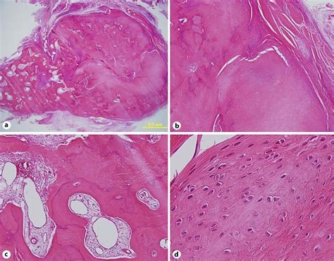 Findings Of An He Stained Specimen A Low Magnification Revealed A