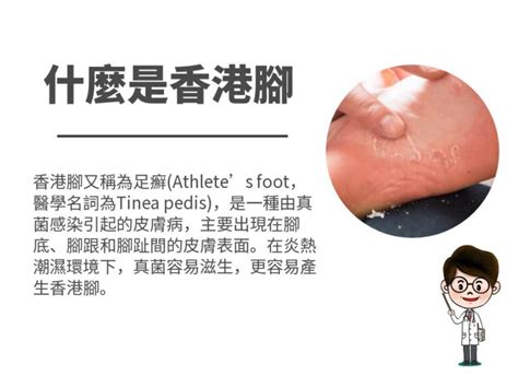 香港腳（足癬）如何治療？5招預防，治療香港腳問題！ 確研皮膚專科中心 Precise Dermatology And Laser Centre