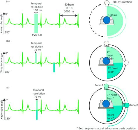 Temporal Resolution In Cardiac Ct Scanning A With A Half Scan
