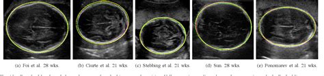 Figure 13 From Evaluation And Comparison Of Current Fetal Ultrasound Image Segmentation Methods