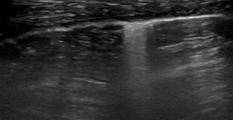 The 2024 ‘italian Protocol For Lung Ultrasound Scoring Vet Practice Support
