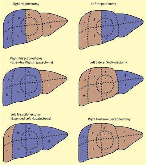 Principles Of Liver Surgery Surgery Oxford International Edition