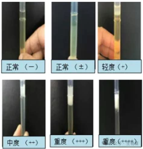 实验技术五:蛋白浓度测定 海南省生物材料与医疗器械工程研究中心 实验技术五:蛋白浓度测定 海南省生物材料与医疗器械工程研究中心
