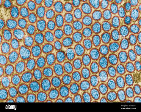 Coloured Transmission Electron Micrograph Tem Showing A Brush Or