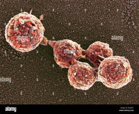 Synthetic Mycoplasma Bacteria Coloured Scanning Electron Micrograph Sem Of Mycoplasma