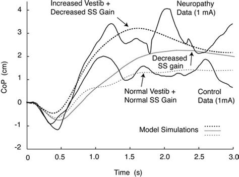 What Causes Segmental And Somatic Dysfunction